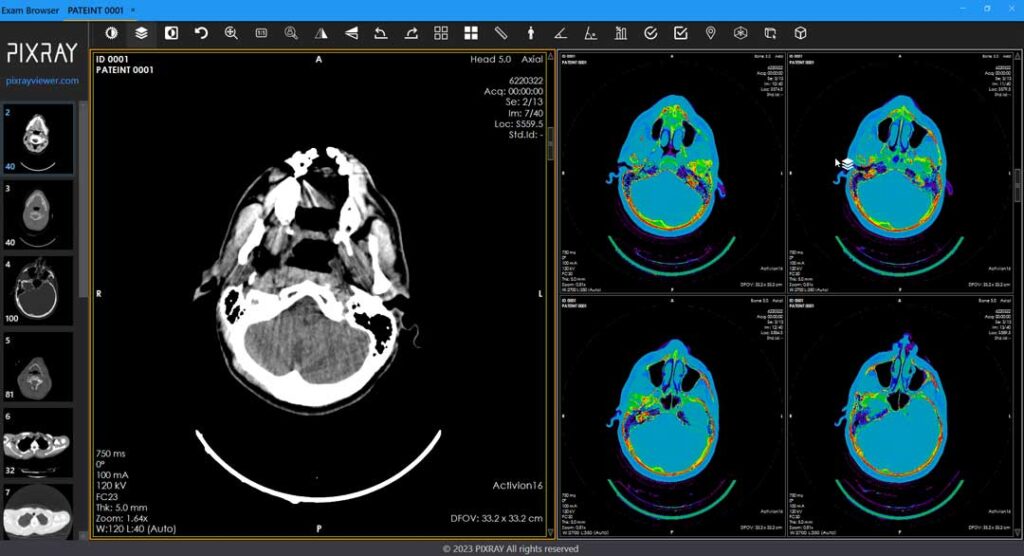 pixray – Where Speed Meets Clarity, Unveiling the Hidden Beauty of ...