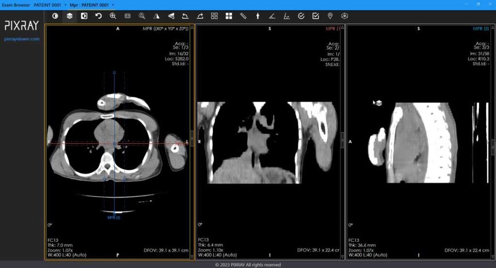 pixray – Where Speed Meets Clarity, Unveiling the Hidden Beauty of ...