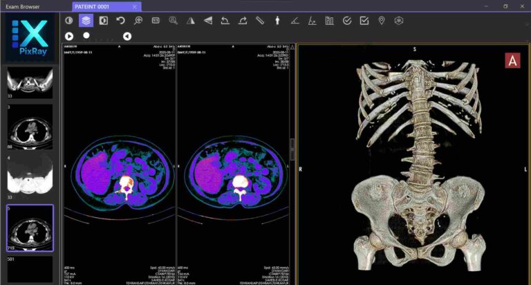 pixray – Where Speed Meets Clarity, Unveiling the Hidden Beauty of ...