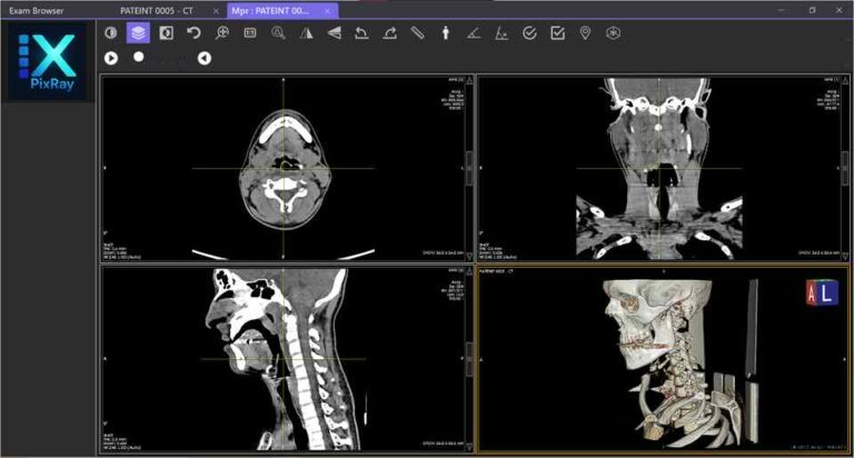 pixray – Where Speed Meets Clarity, Unveiling the Hidden Beauty of ...