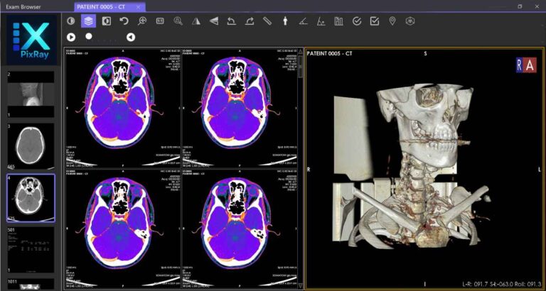 pixray – Where Speed Meets Clarity, Unveiling the Hidden Beauty of Medical Images